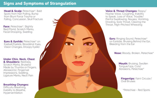 Signs of Strangulation | 180 Turning Lives Around