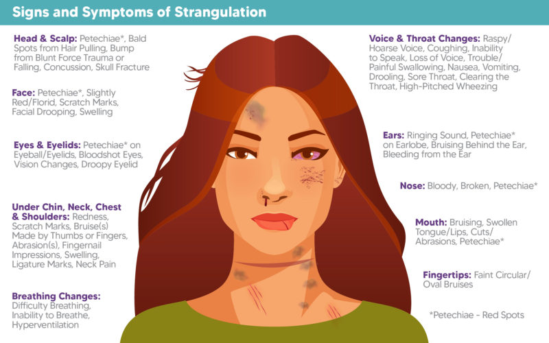 Signs of Strangulation | 180 Turning Lives Around